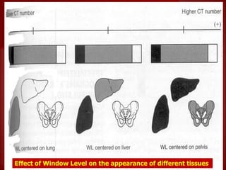 Basics of CT- Lecture 7.ppt