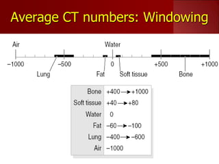 Basics of CT- Lecture 7.ppt