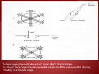 Basics of CT- Lecture 9.ppt