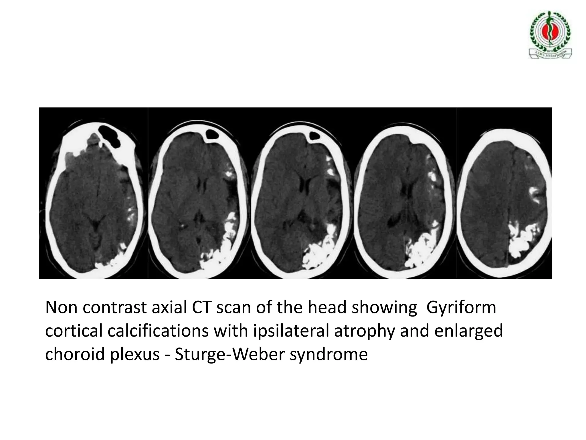 Workshop on Neuroimaging - APICON 2020 | PPTX