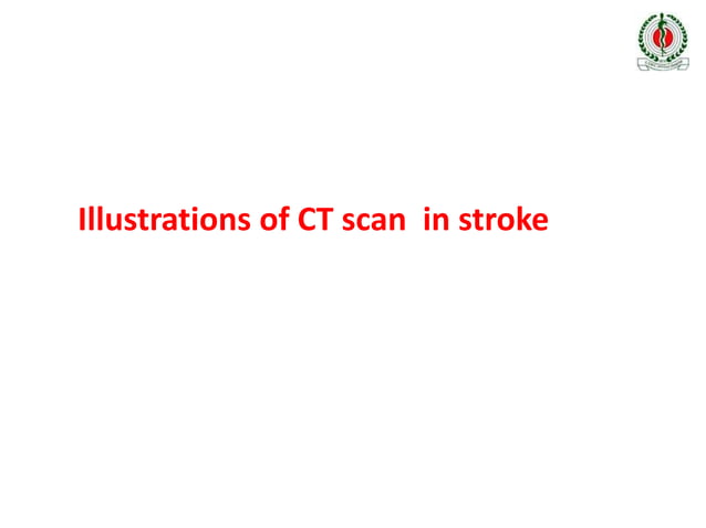 Workshop on Neuroimaging - APICON 2020 | PPT