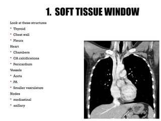 Basics of CT chest including different views and how to read a chest ct ...
