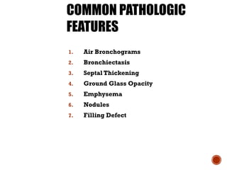 Basics of CT chest including different views and how to read a chest ct ...