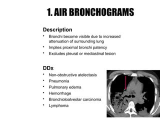 Basics of CT chest including different views and how to read a chest ct ...