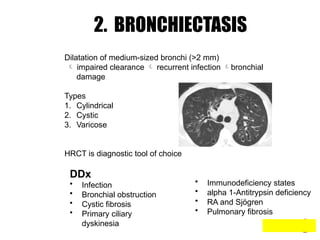 Basics of CT chest including different views and how to read a chest ct ...