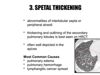 Basics of CT chest including different views and how to read a chest ct ...