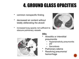 Basics of CT chest including different views and how to read a chest ct ...