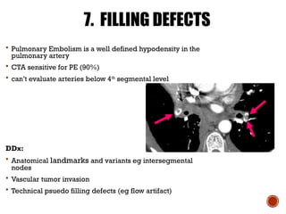 Basics of CT chest including different views and how to read a chest ct ...