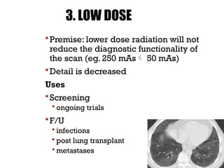 Basics of CT chest including different views and how to read a chest ct ...