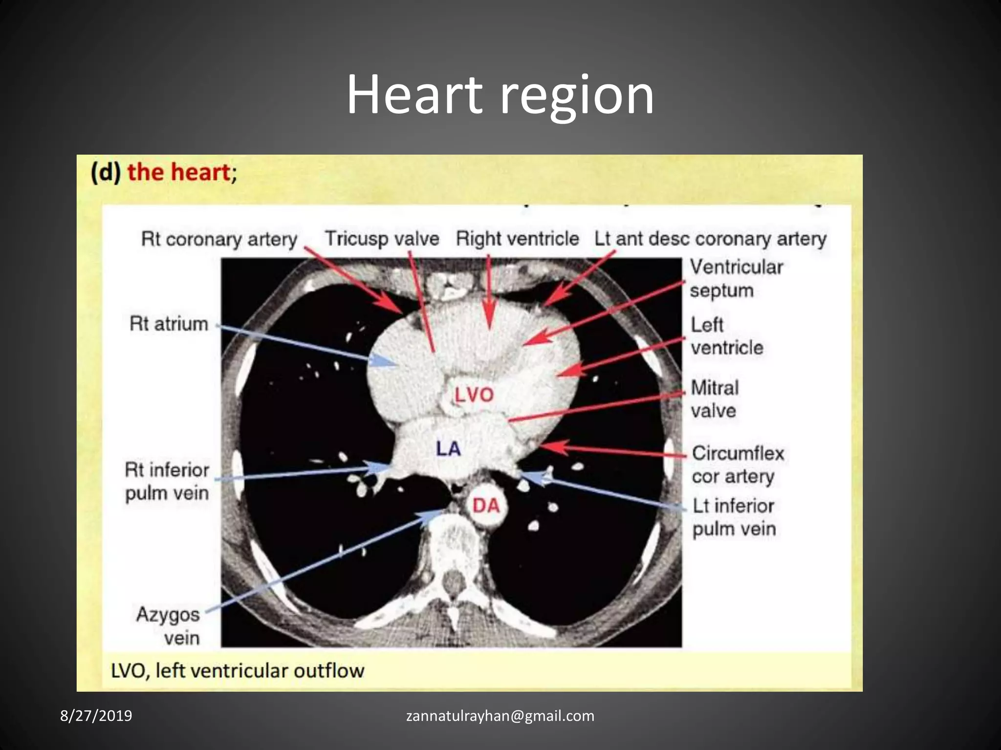 Basics of CT Chest | PPTX