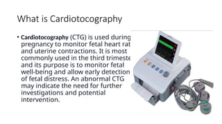 BASICS OF CTG MONITORING INTERPRETATION.pptx