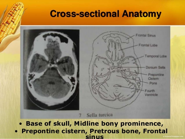 Basics of ct mri