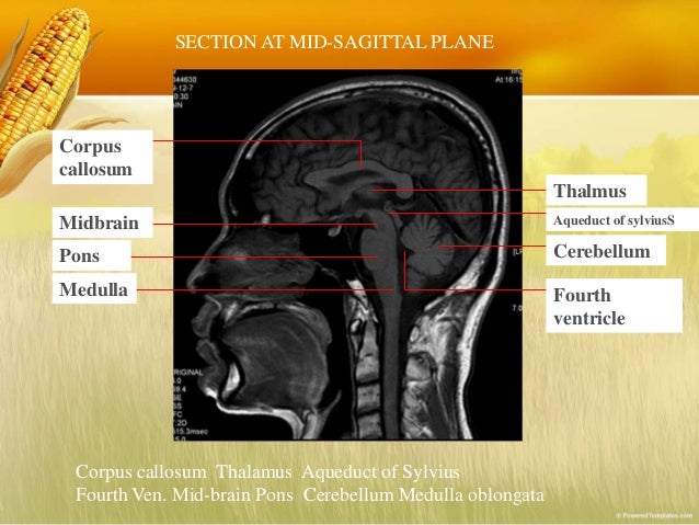 Brain Mri Medulla