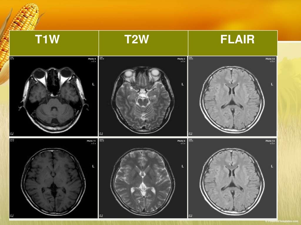 Basics of ct mri