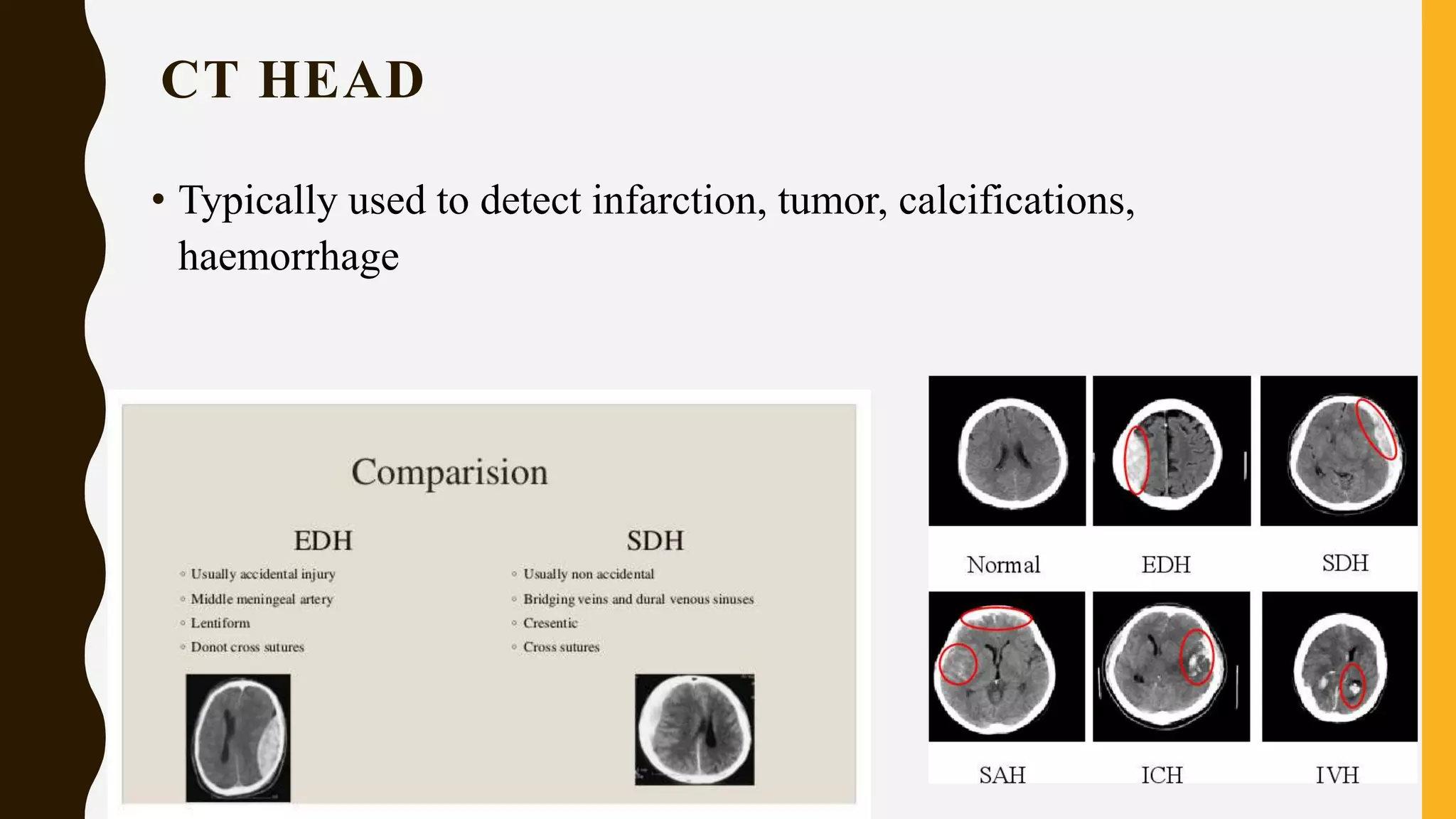 Basics of ct scan | PPTX