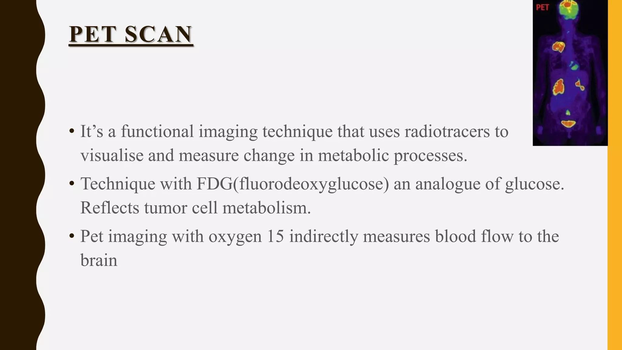 Basics of ct scan | PPTX
