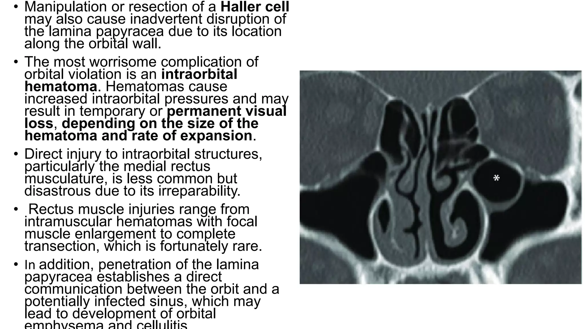 Basics of CT Scan interpretation of paranasal sinuses.pptx