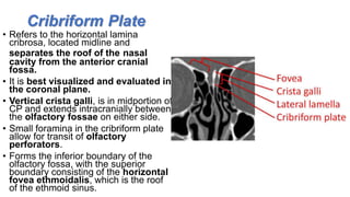 Basics of CT Scan interpretation of paranasal sinuses.pptx