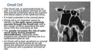Basics of CT Scan interpretation of paranasal sinuses.pptx