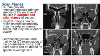 Basics of CT Scan interpretation of paranasal sinuses.pptx