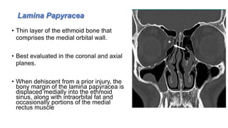 Lamina Papyracea Fracture