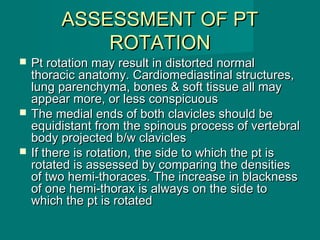 Basics Of CXR interpretation www.radiologydefinition.com
