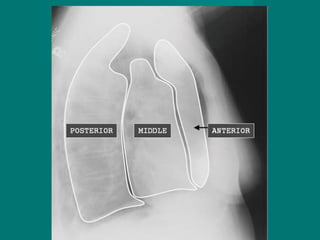 Basics Of CXR interpretation www.radiologydefinition.com