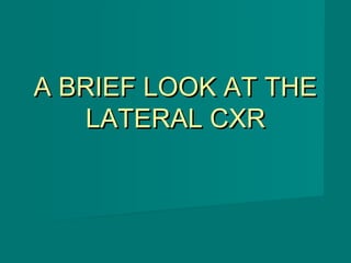 Basics Of CXR interpretation www.radiologydefinition.com