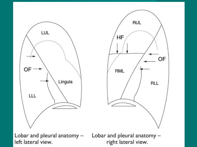 Basics Of CXR interpretation www.radiologydefinition.com