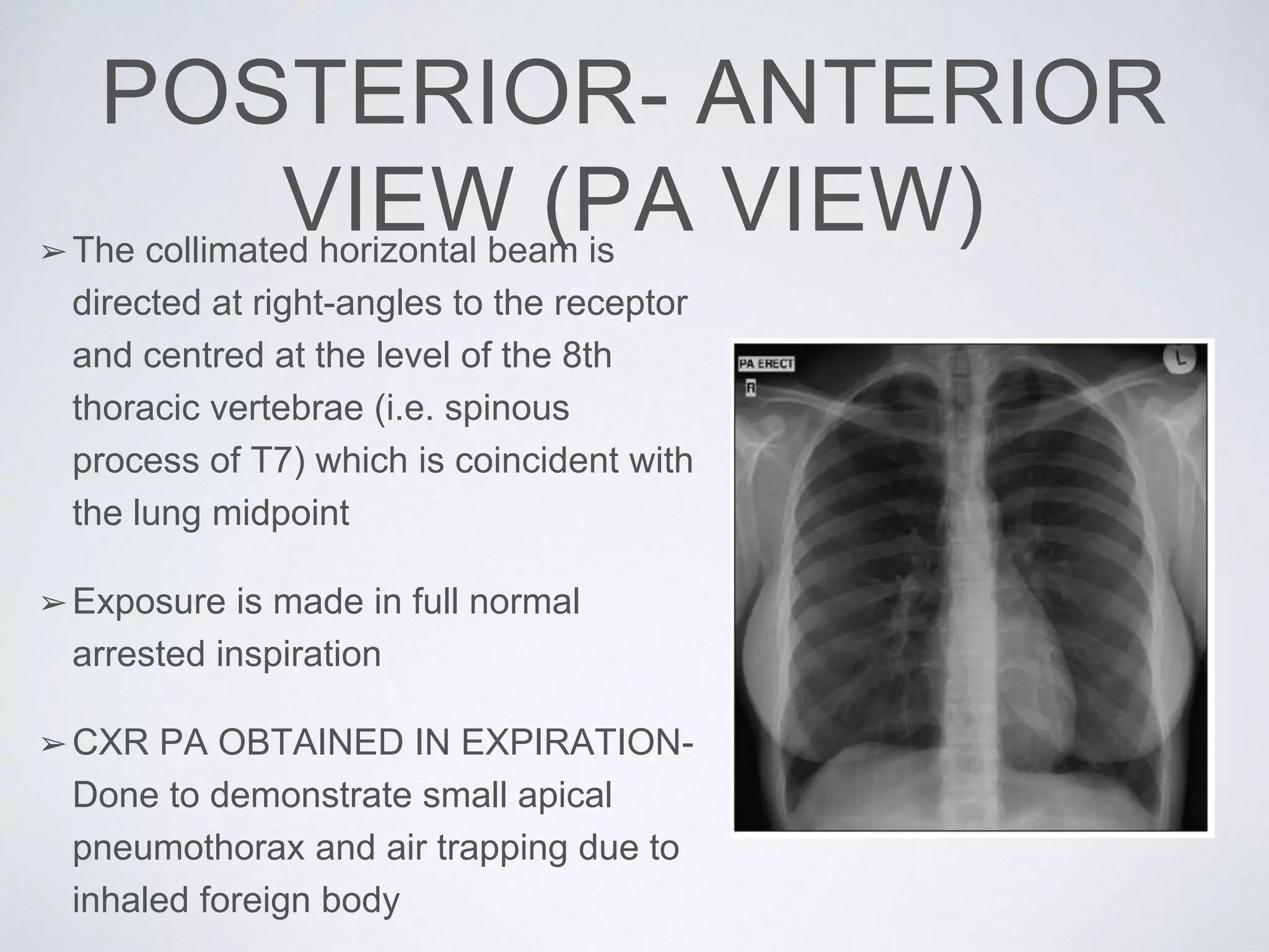 Basics of cxr modified ppt | PPTX
