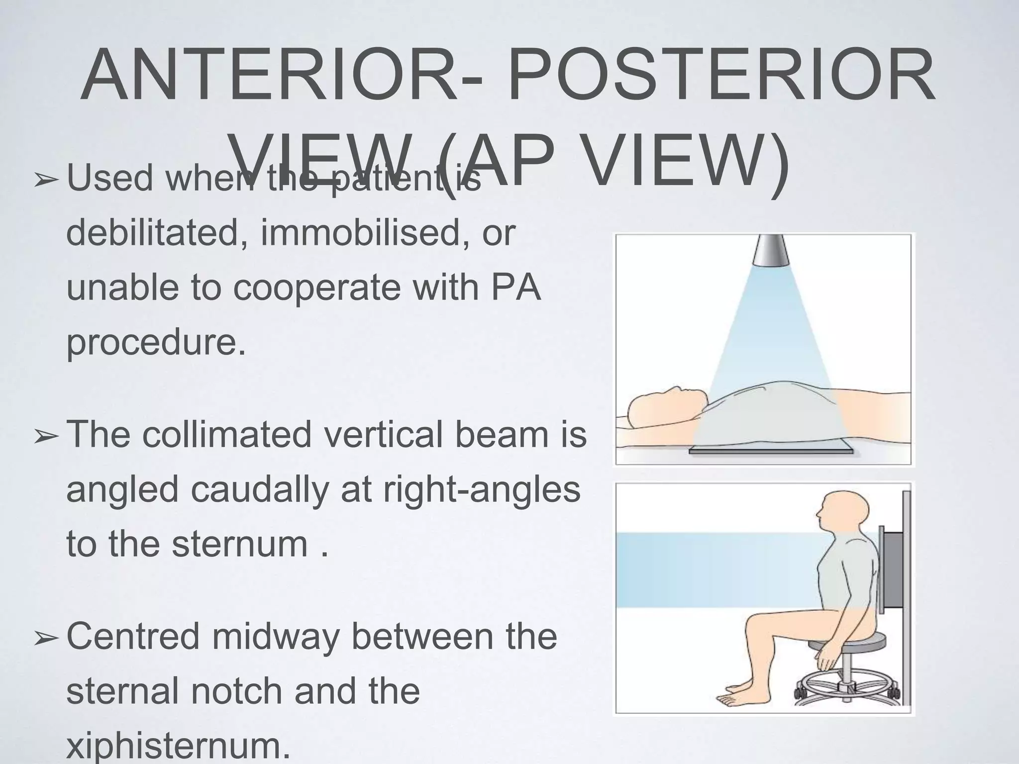 Basics of cxr modified ppt | PPTX