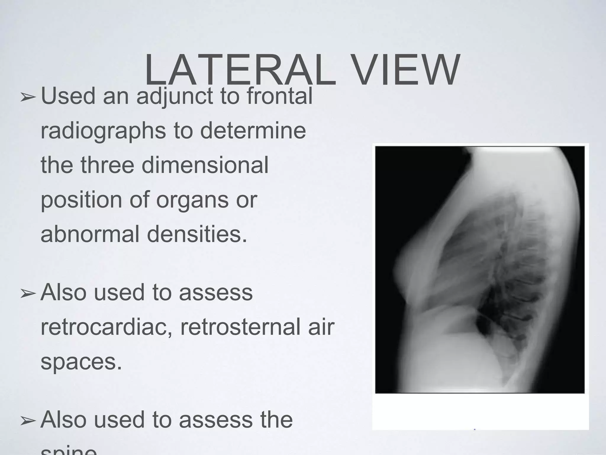 Basics of cxr modified ppt | PPTX