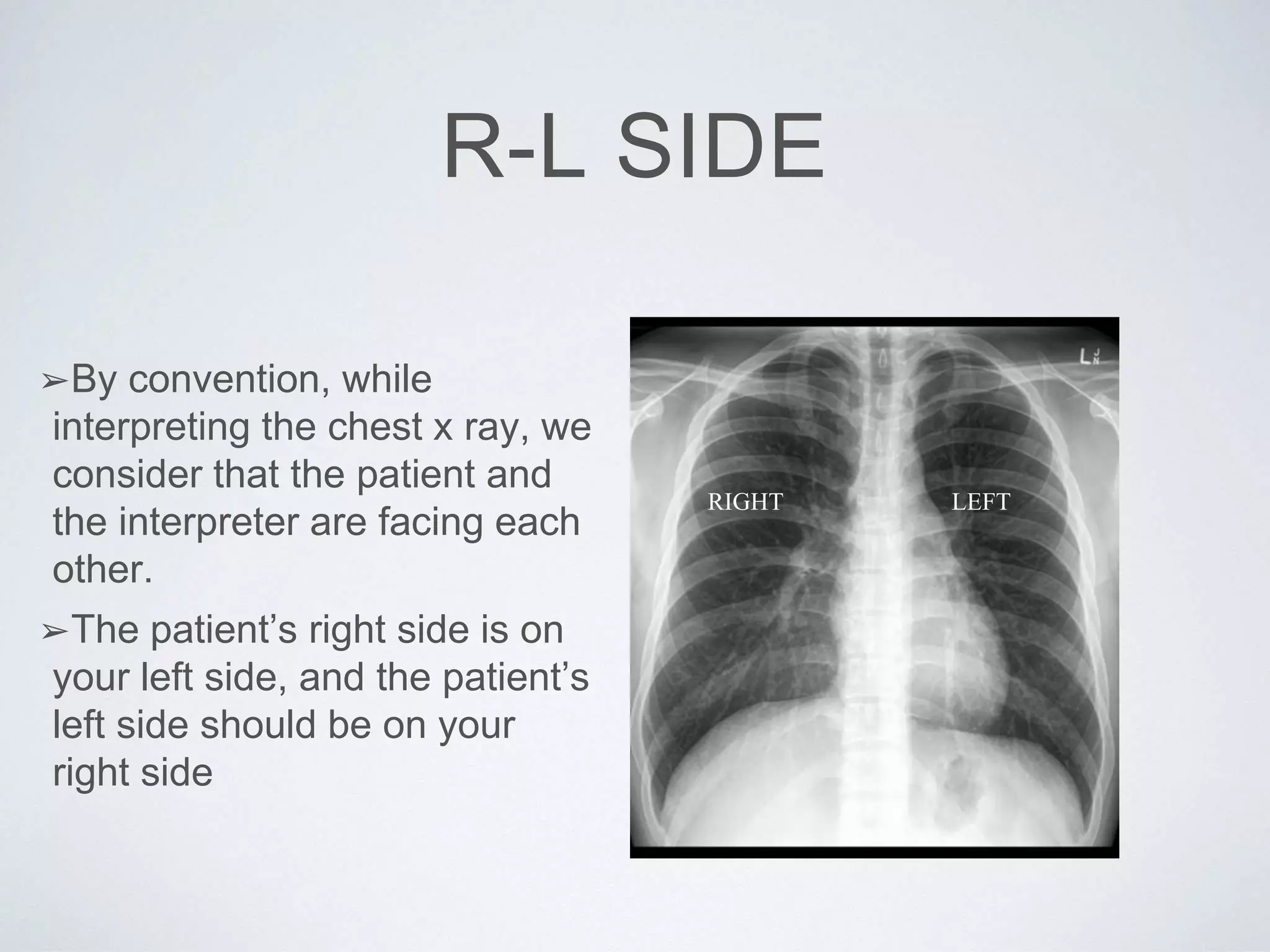 Basics of cxr modified ppt | PPTX