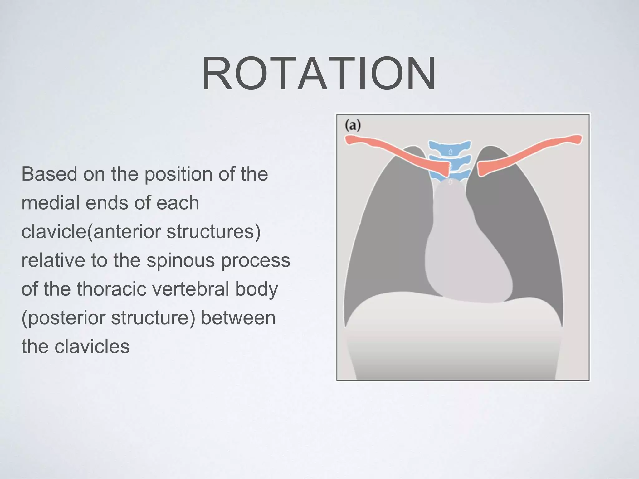 Basics of cxr modified ppt | PPTX