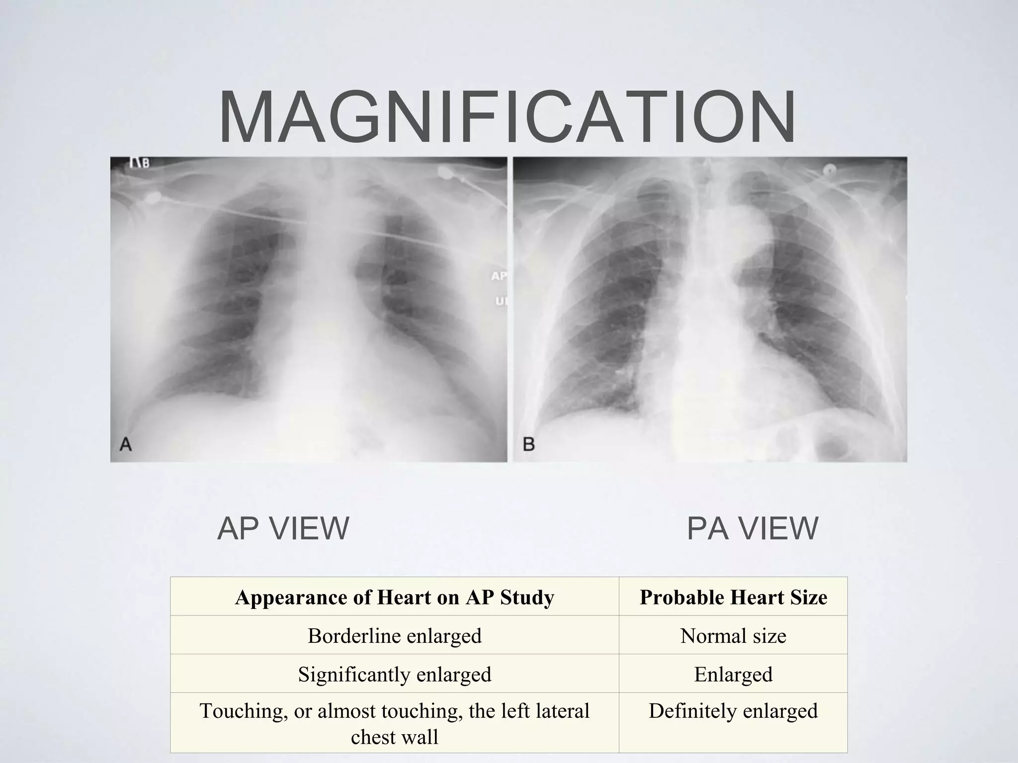 Basics of cxr modified ppt | PPTX