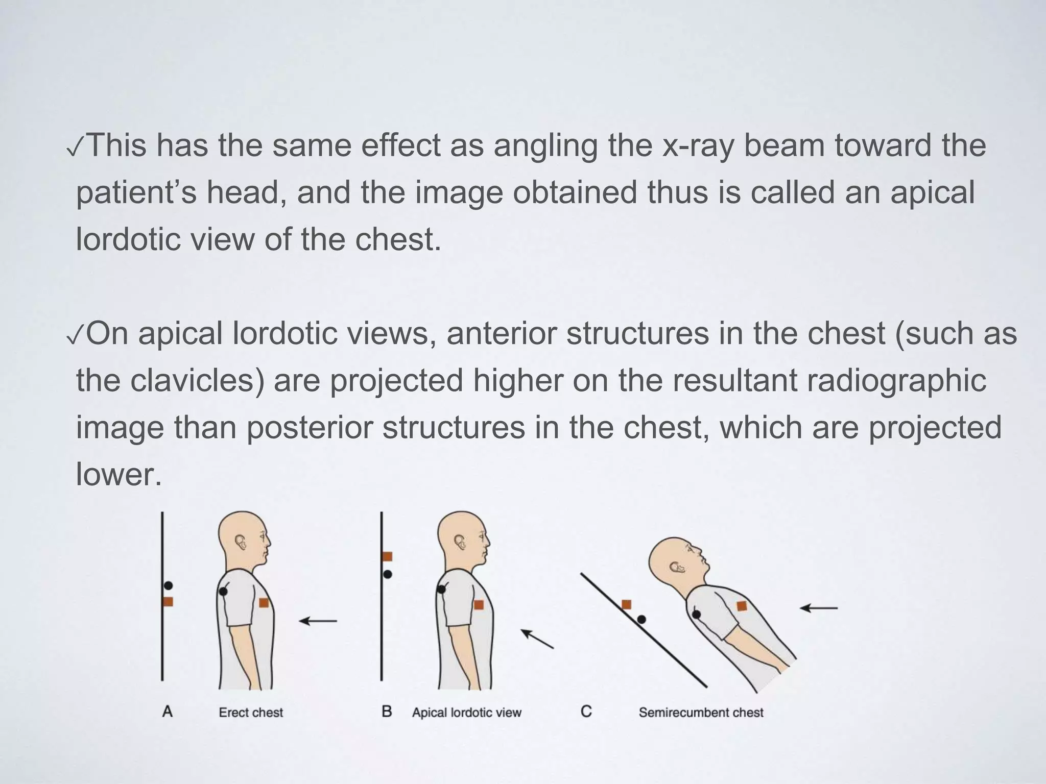 Basics of cxr modified ppt | PPTX