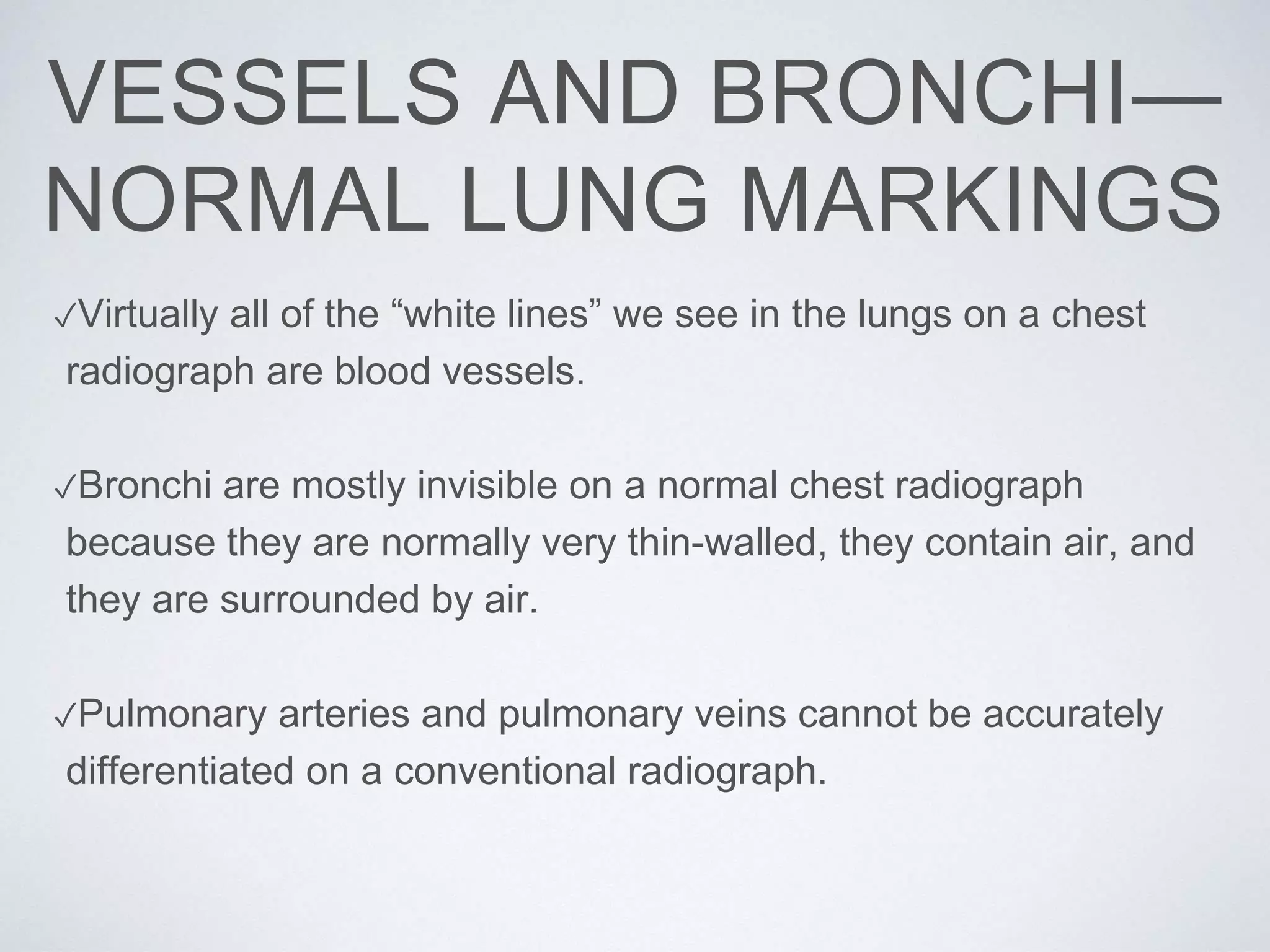 Basics of cxr modified ppt | PPTX