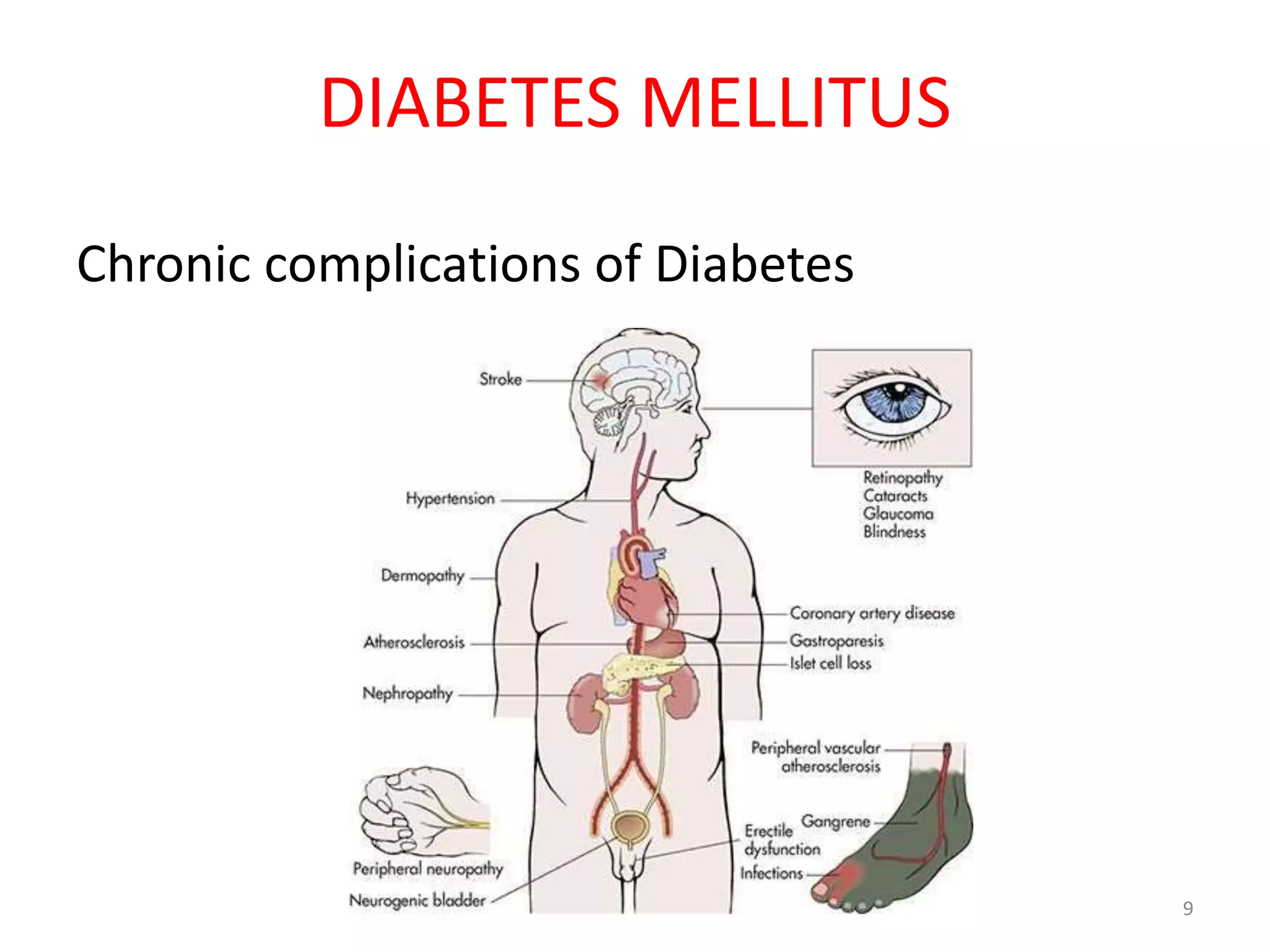 Basics of diabetes mellitus by dr.qurban hussain | PPTX