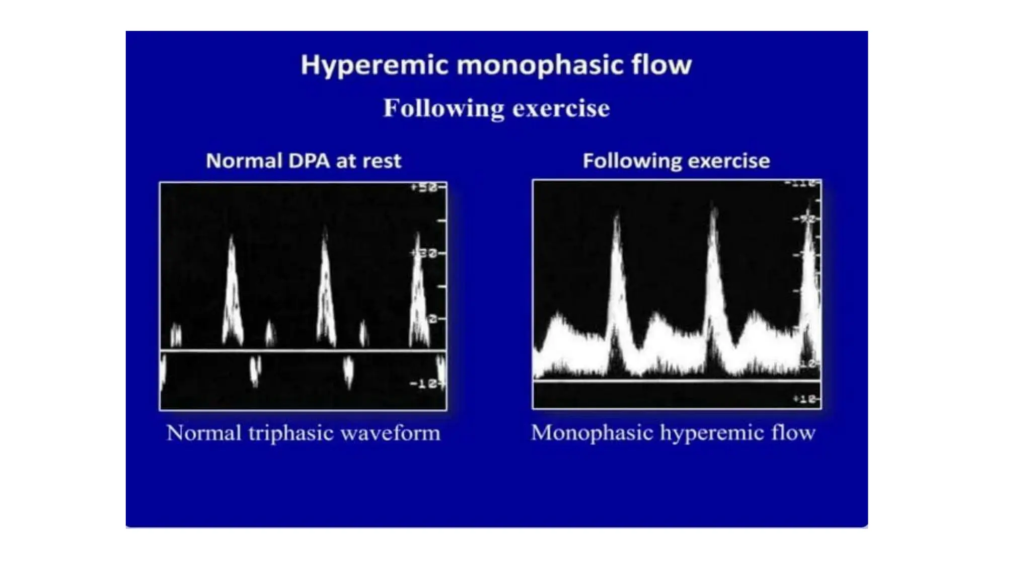 Basics of Doppler Ultrasound .pptx