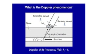 Basics of Doppler Ultrasound .pptx