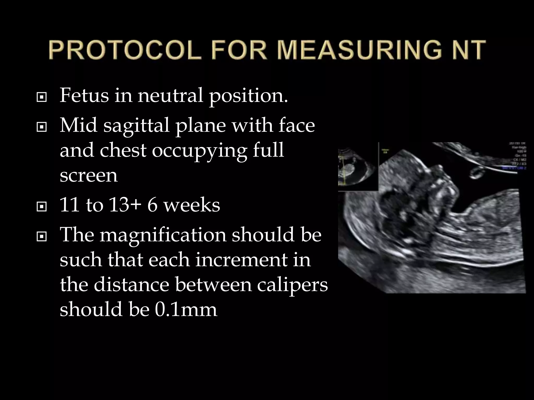 Basics of early pregnancy scan.pptx