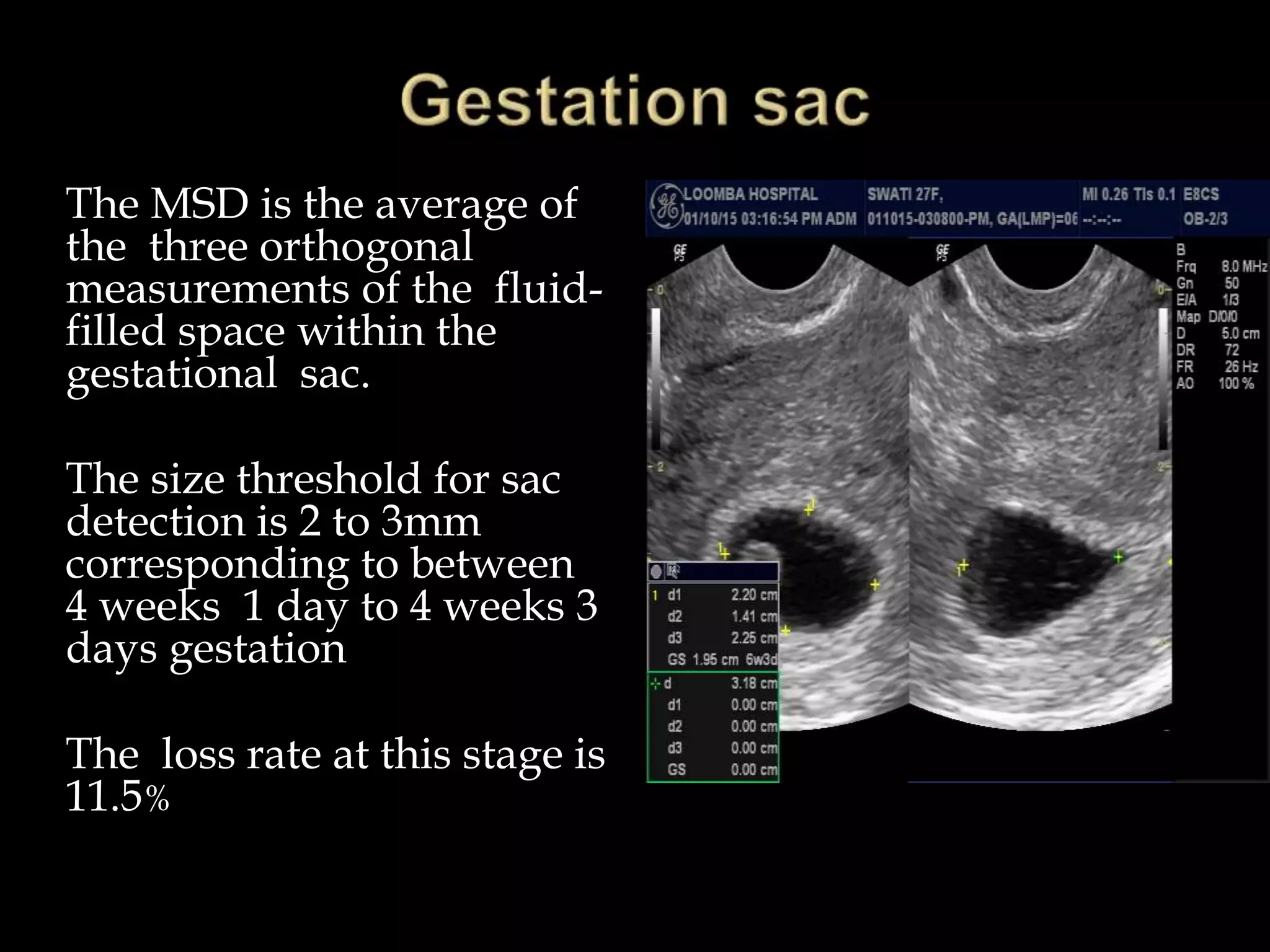 Basics of early pregnancy scan.pptx