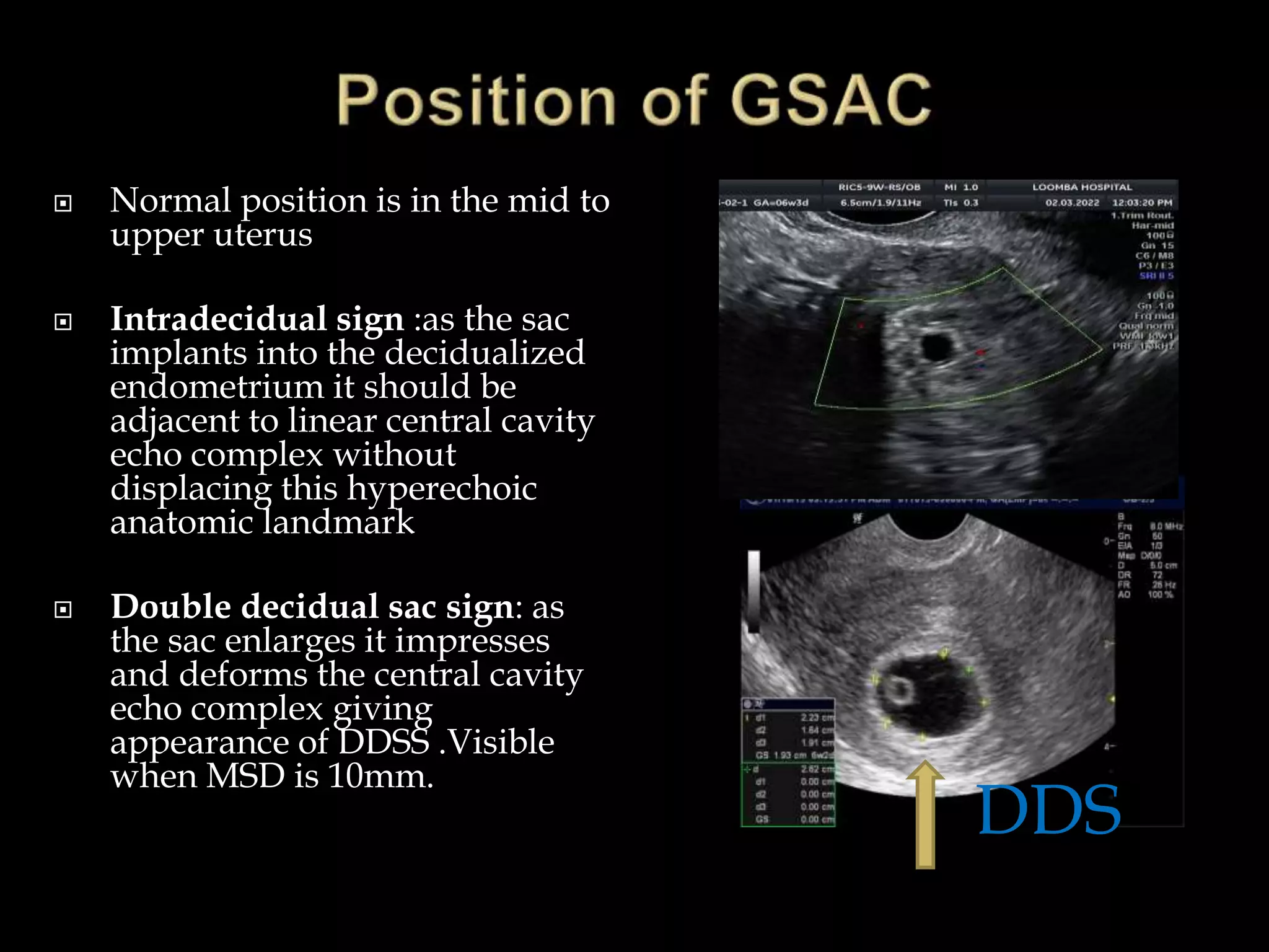 Basics of early pregnancy scan.pptx