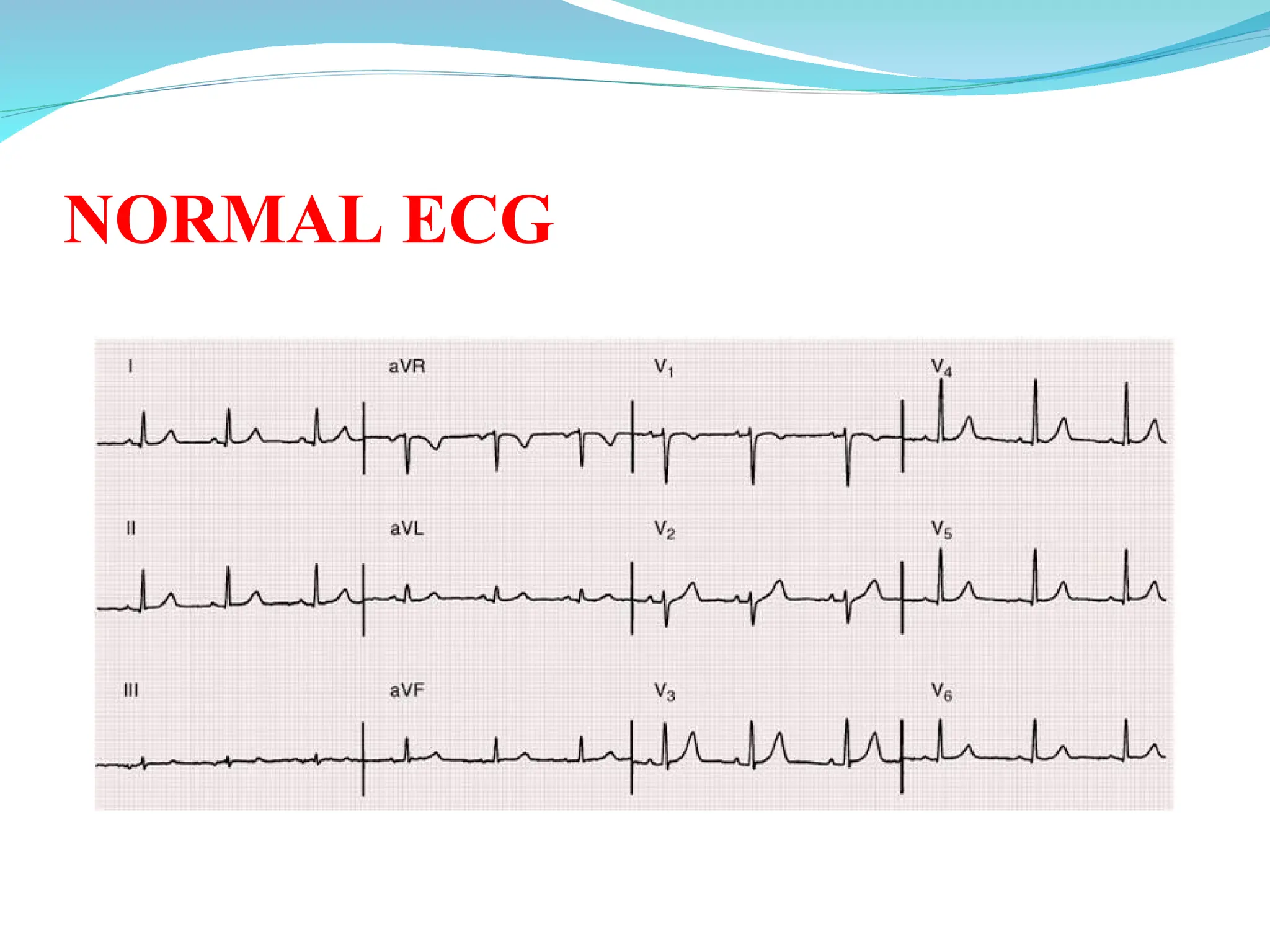 The basics of ECG and its interpretation | PPT
