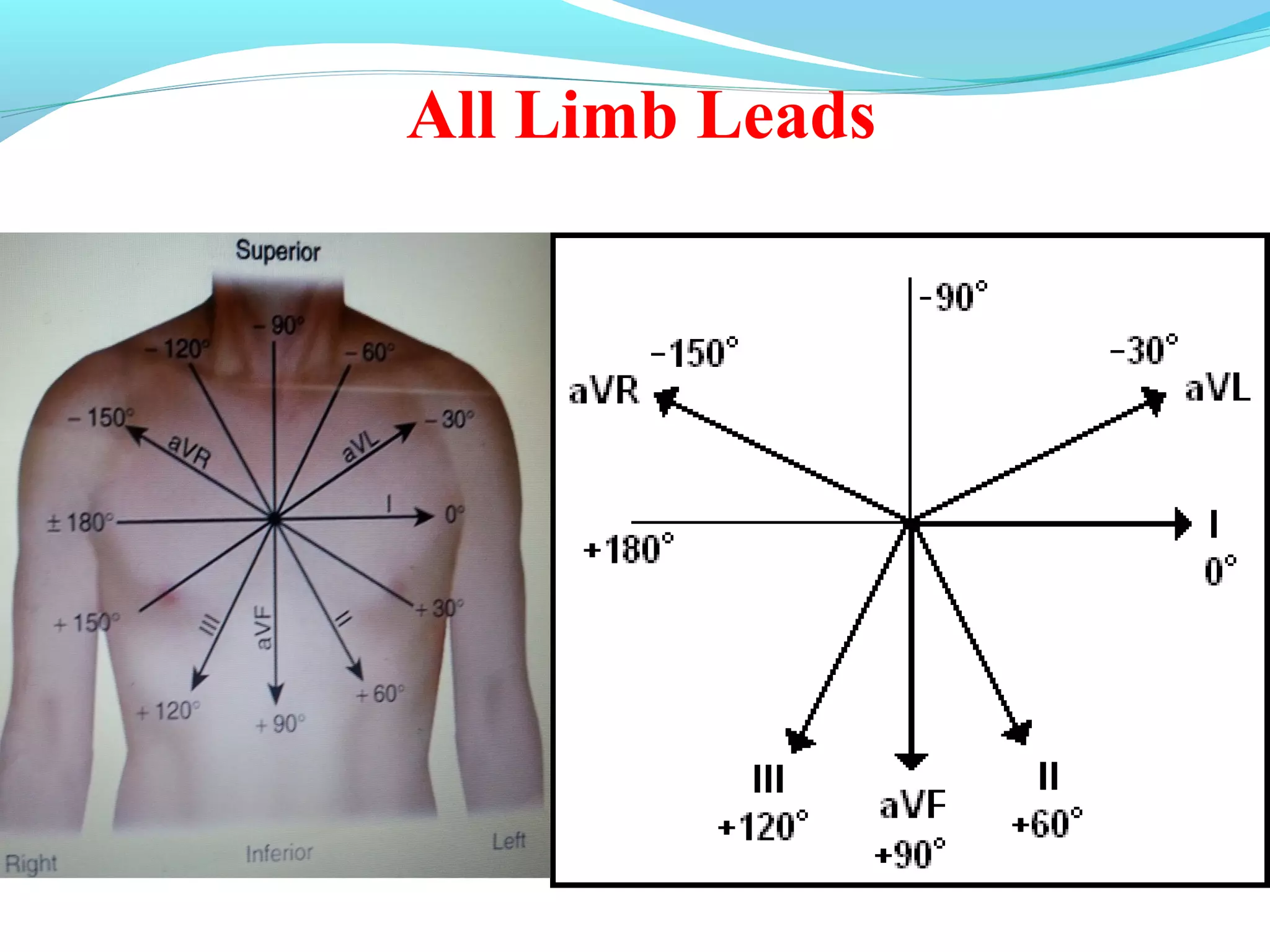 Basics of Electrocardiography(ECG) | PPT