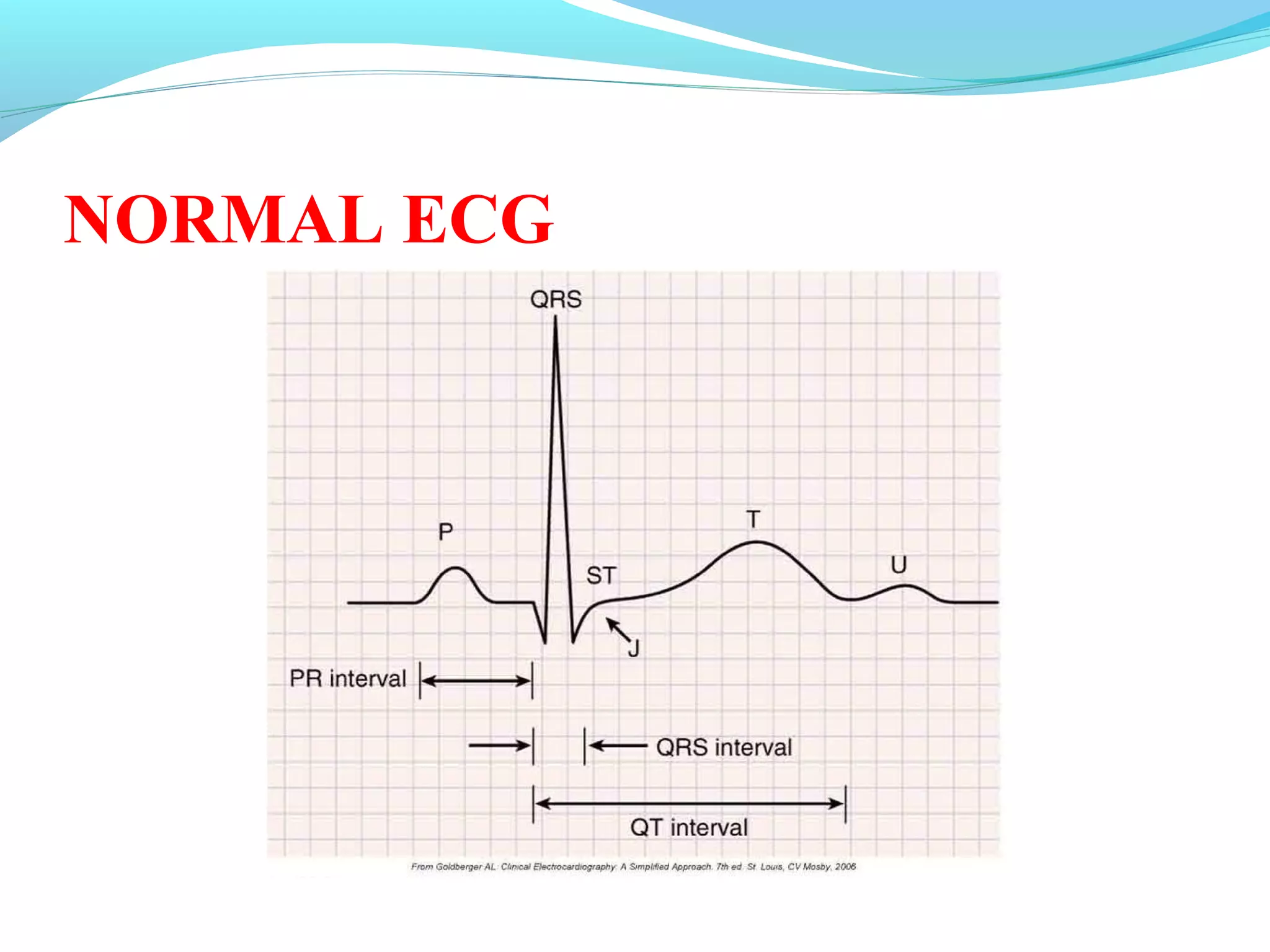 Basics of Electrocardiography(ECG) | PPT