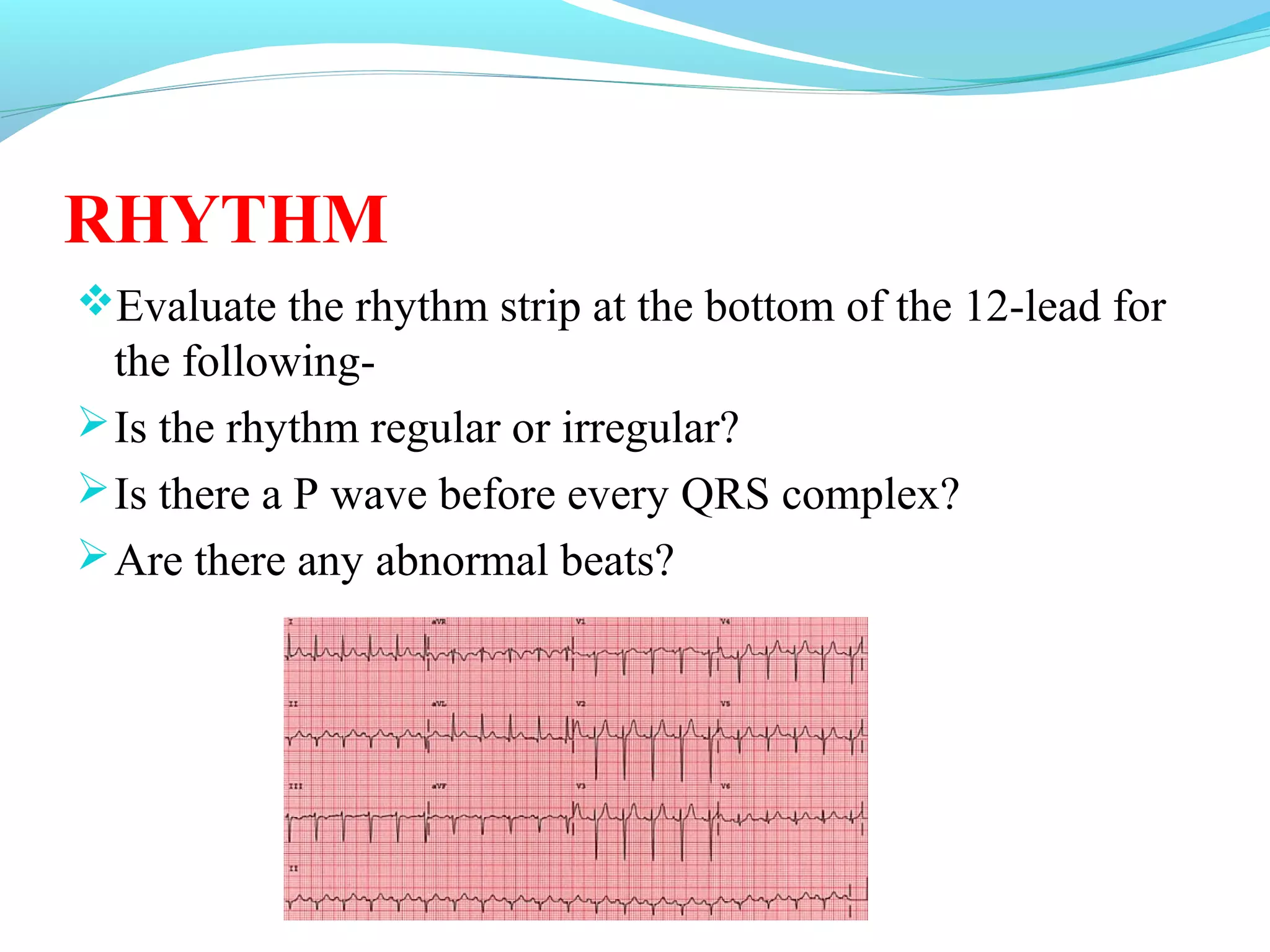 Basics of Electrocardiography(ECG) | PPT