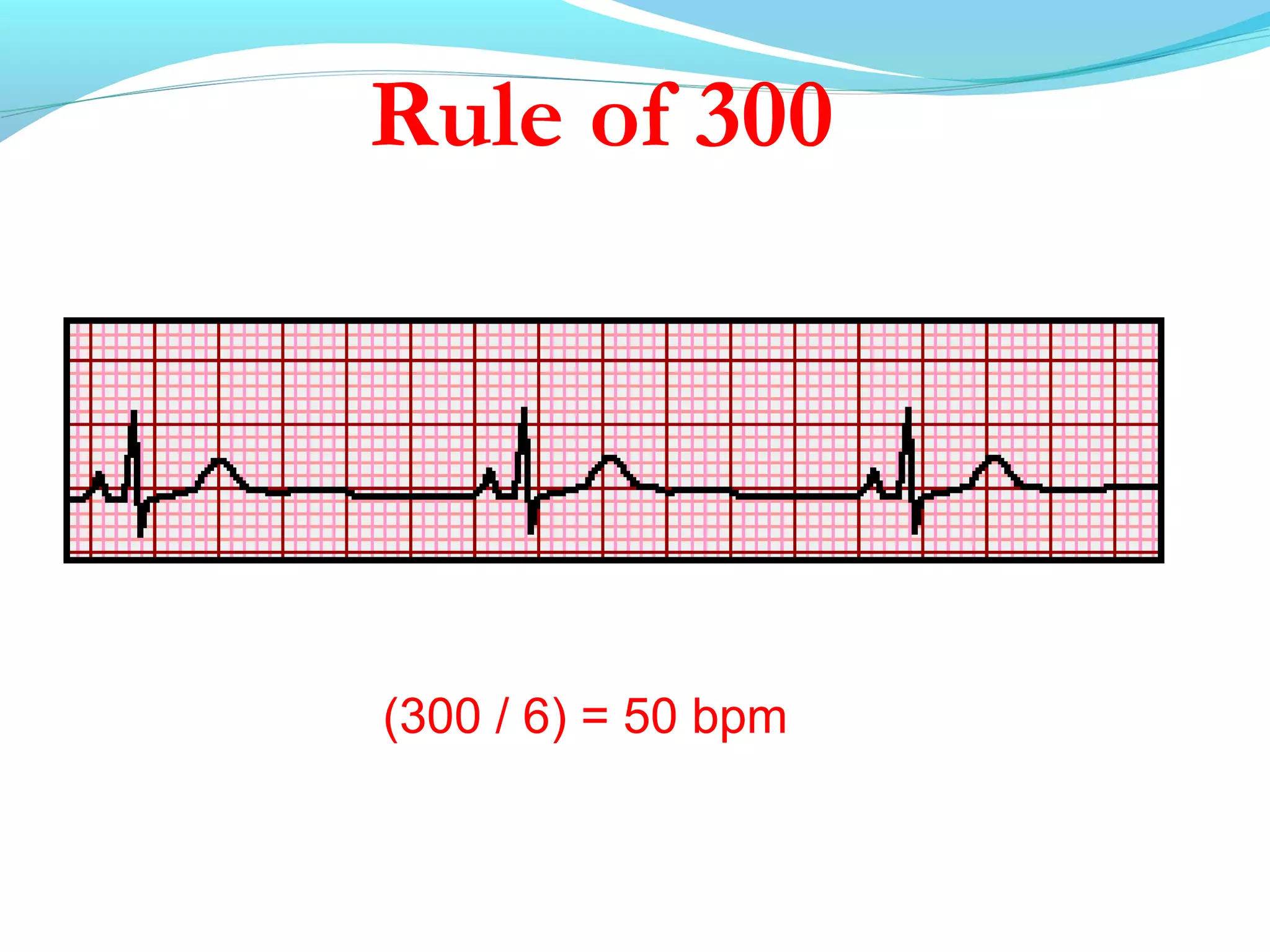 Basics of Electrocardiography(ECG) | PPT