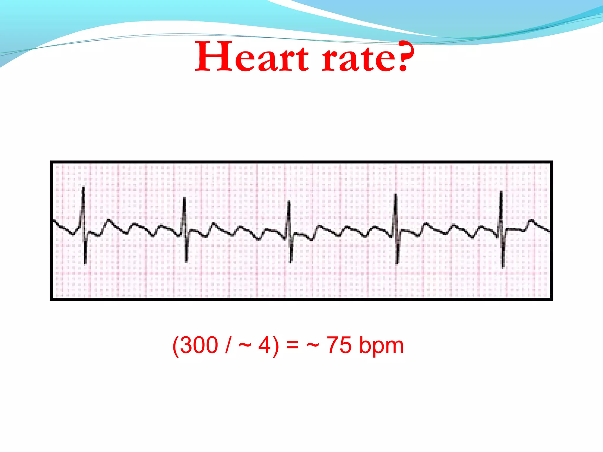 Basics of Electrocardiography(ECG) | PPT