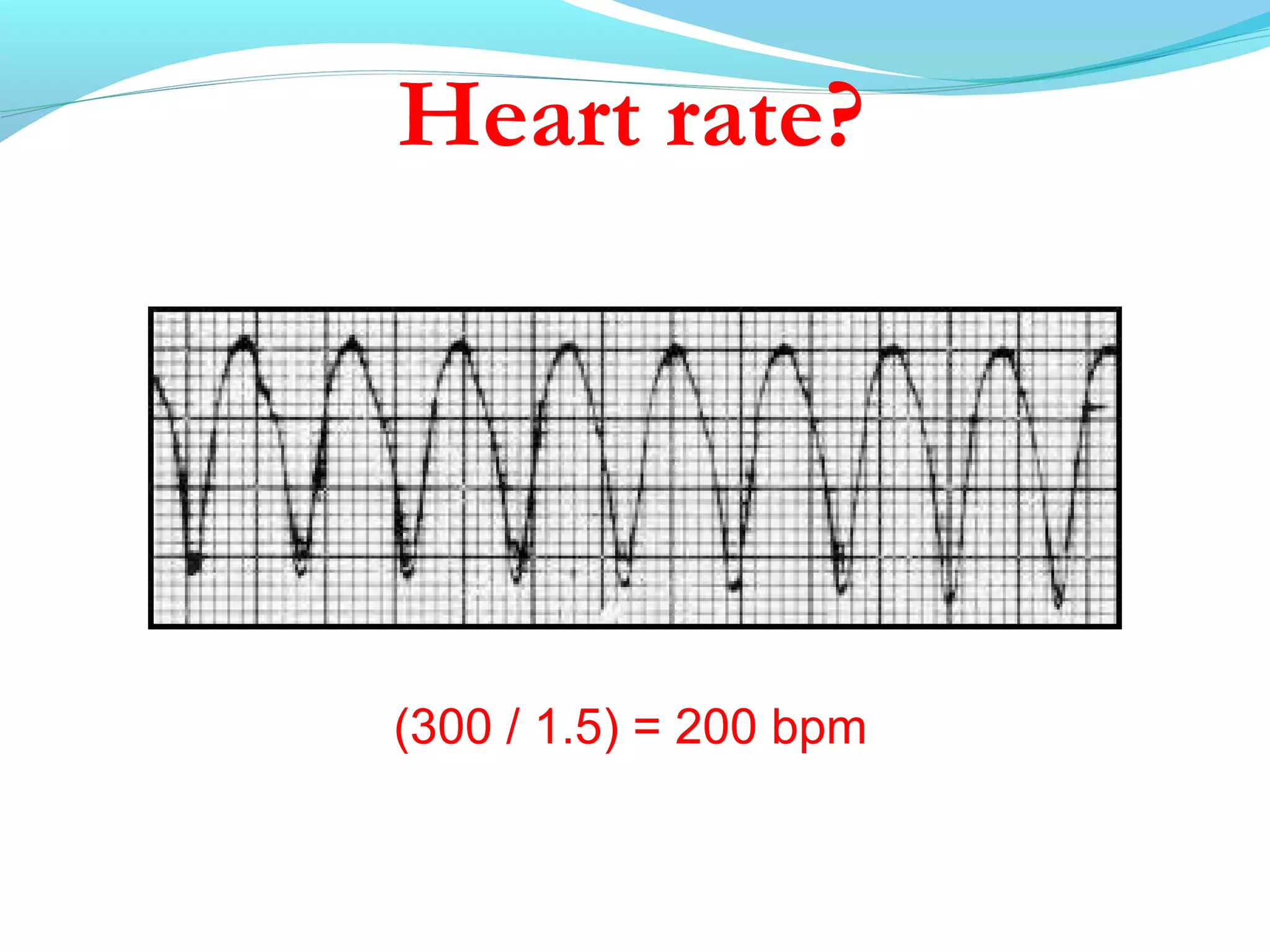 Basics of Electrocardiography(ECG) | PPT